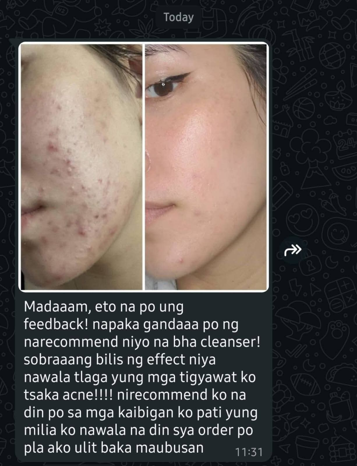 This skincare duo helps clear acne and pores and comes with 8 free ...